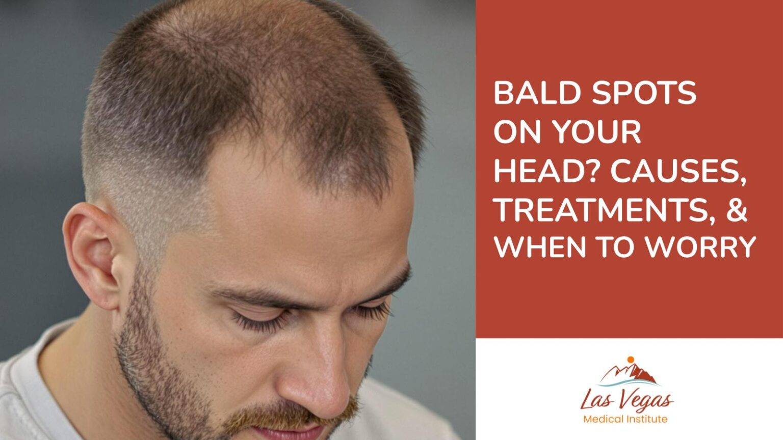 Bald Spots on Your Head? Causes, Treatments, When to Worry - Las Vegas ...