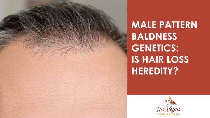 Male Pattern Baldness Genetics: Is Hair Loss Heredity? - Las Vegas ...