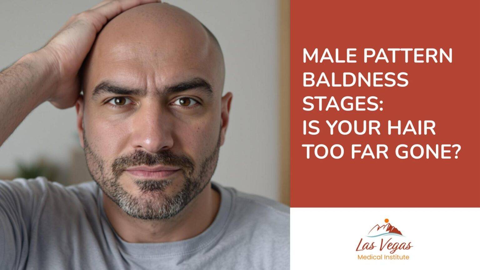 Male Pattern Baldness Stages: Is Your Hair Too Far Gone? - Las Vegas ...