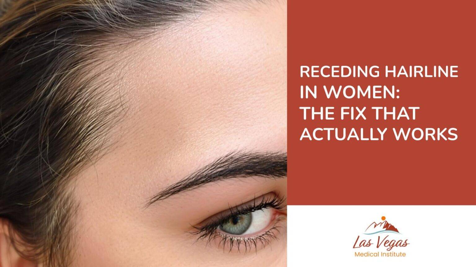 Receding Hairline in Women: The Fix That Actually Works - Las Vegas ...