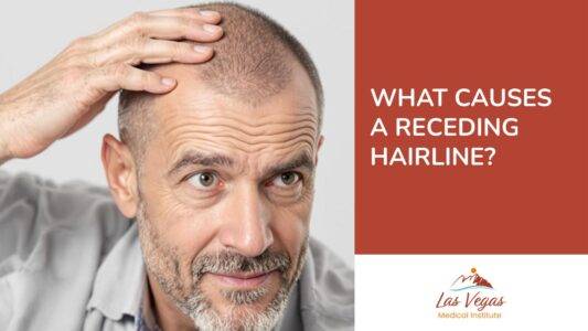 What Causes a Receding Hairline? - Las Vegas Medical Institute in Nevada